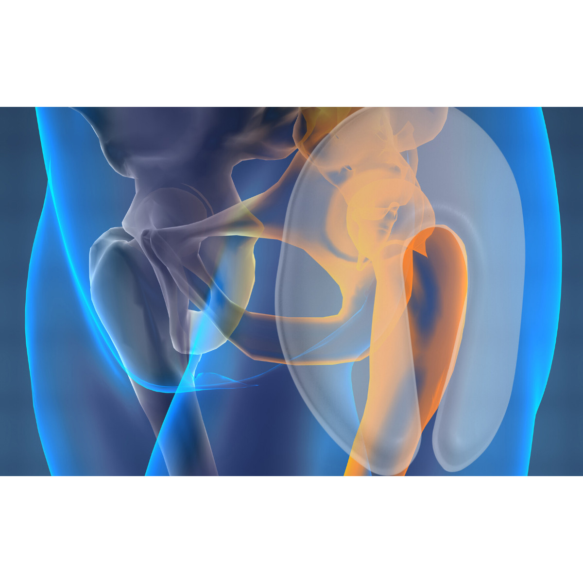 SAFEHIP® AirX® Unisex Hip Protector Pants | CLH Healthcare